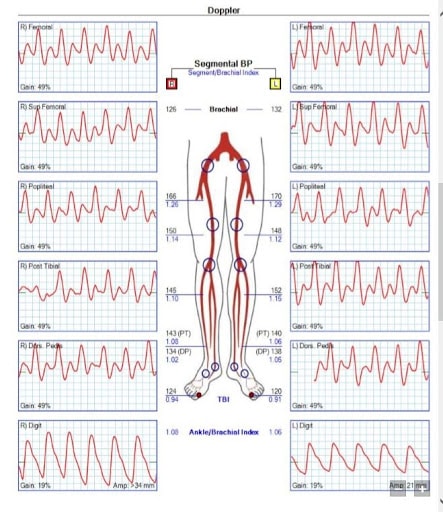 Patient Resource Hub - Society for Vascular Ultrasound